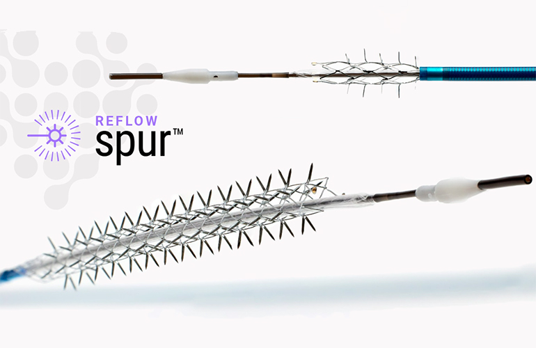 Reflow Medical Wins Ce Mark For Temporary Spur Stent